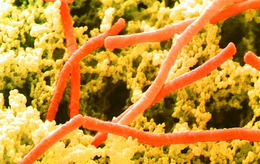 ЗДРАВЕ ЗА ВСИЧКИ: Lactobacillus Bulgaricus (Лактобацилус Булгарикус)
