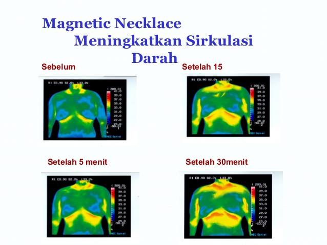 Cara Kerja Kalung Gelang Magnet - Terapi Sehat : Info Kesehatan Medis ...