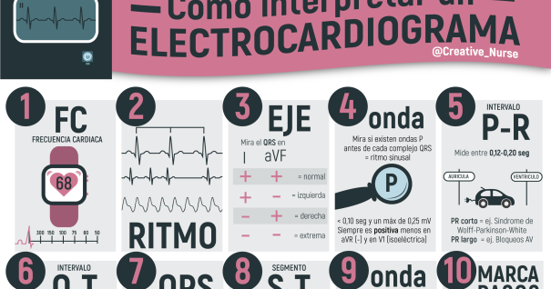 Health Technology News: Una fresca Herramienta como leer un ECG o EKG