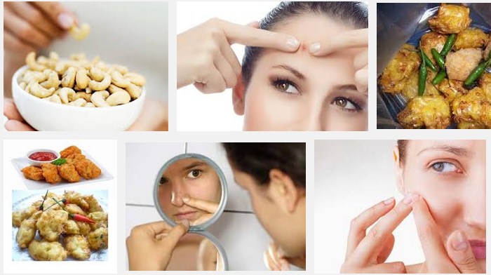 Makanan Penyebab Jerawat Batu Pasir Dan Komedo Yang Muncul di Muka ...