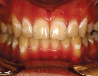 Central Minnesota Orthodontics Blog