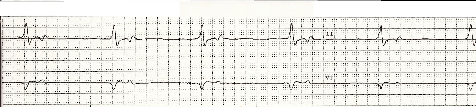 For in that sleep of death what dreams may come...