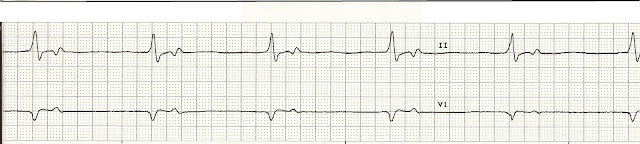 For in that sleep of death what dreams may come...