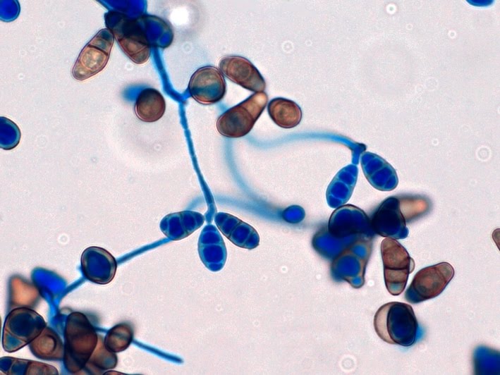 Fun With Microbiology (What's Buggin' You?): Curvularia sp.