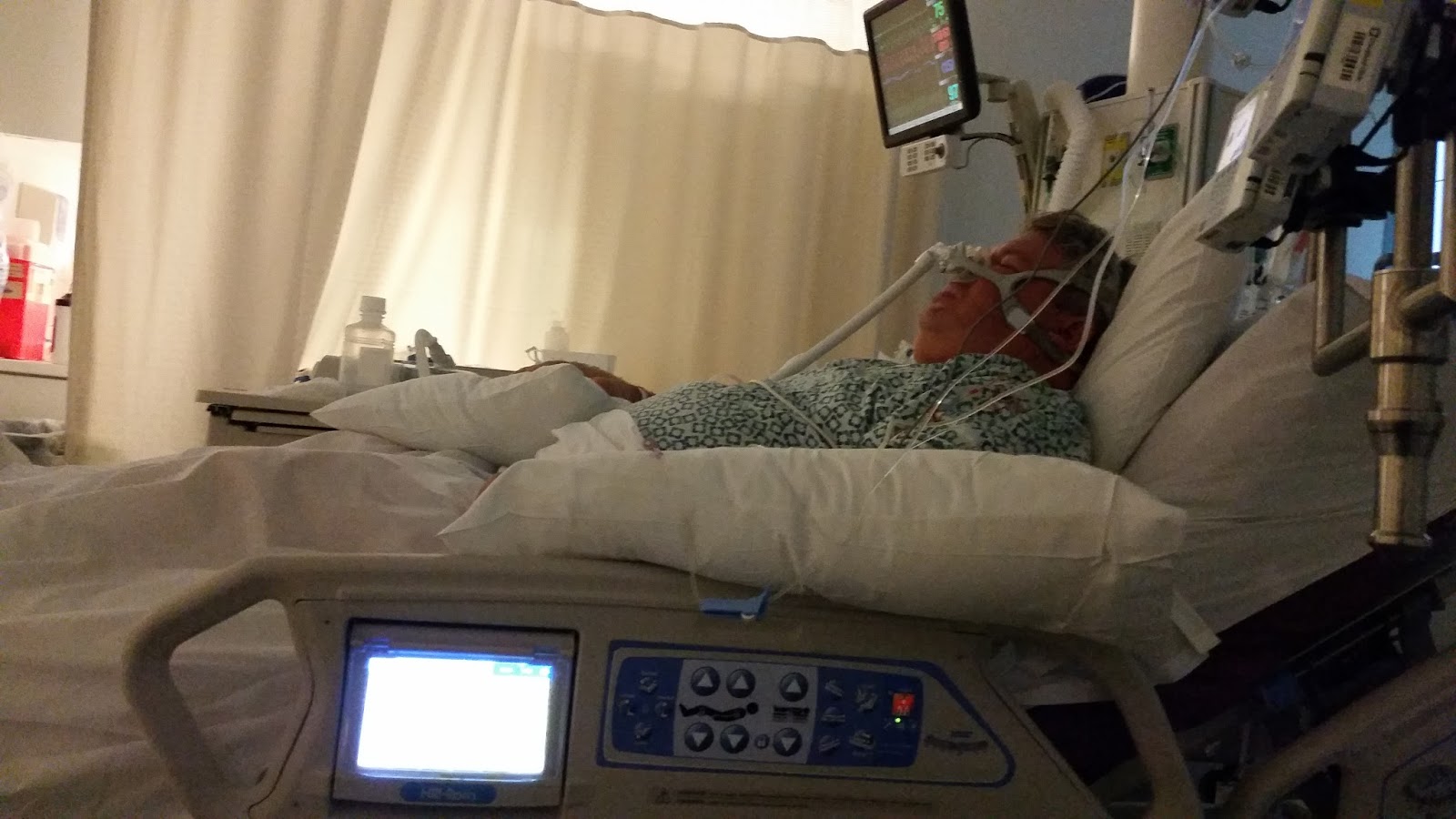 MY HCM STORY - Living with Hypertrophic Cardiomyopathy: SEPTAL MYECTOMY ...