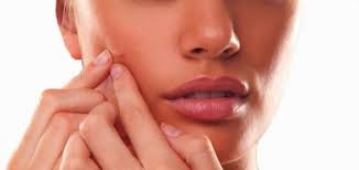 Dicas da Alfinha: Espinha Interna - Dicas para secar a espinha em um dia.