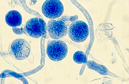 Basidiobolus: Basidiobolus