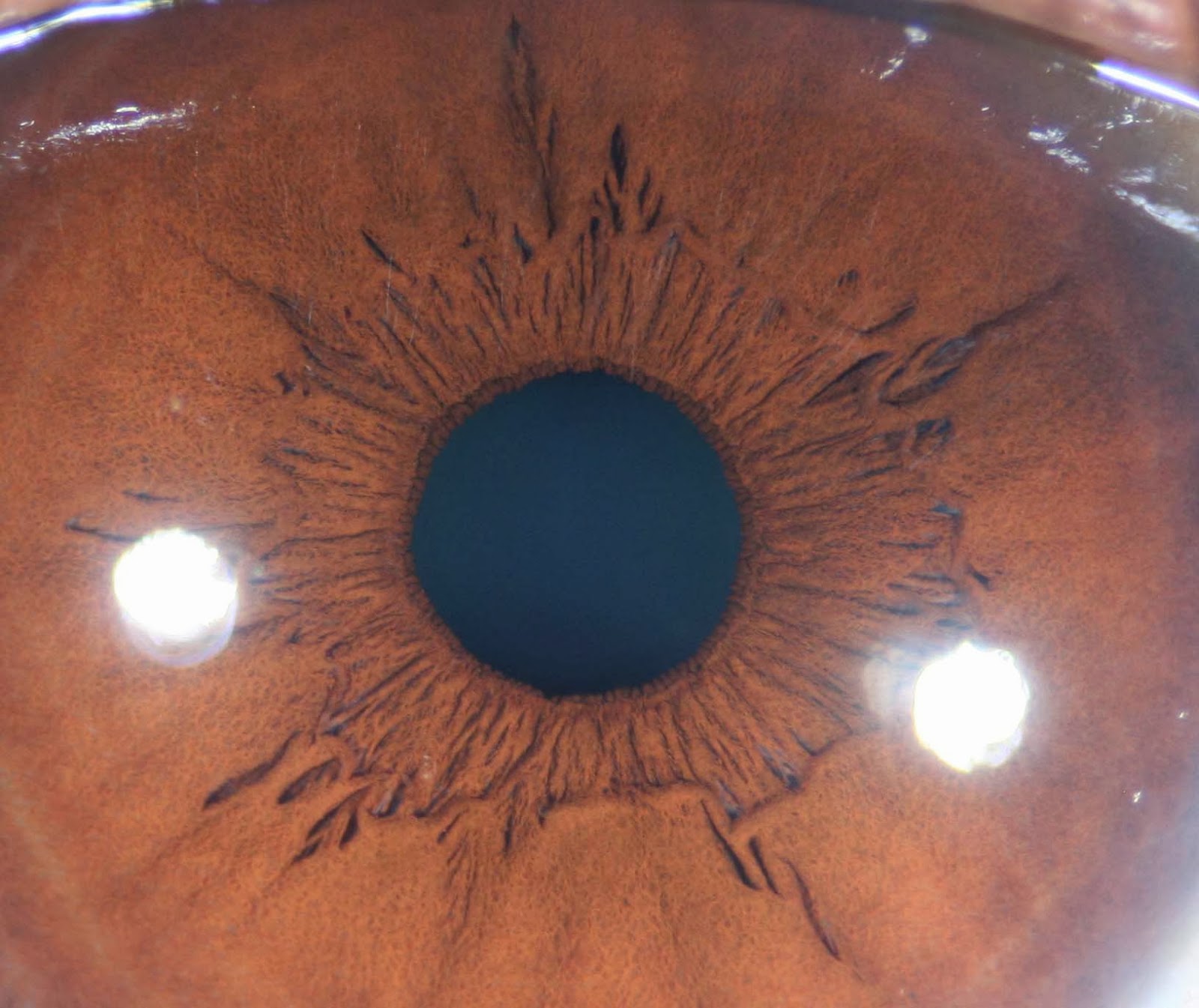 Modern & Multidimensional Iridology: IPB, Pupil, Pupillary Zone ...