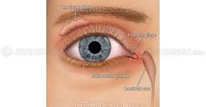 TheraLife: Punctal Plugs for Dry Eye Treatment- Pros and Cons.