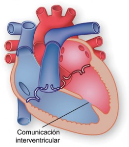 Patología Sistemica I: Persistencia del orificio interventricular.