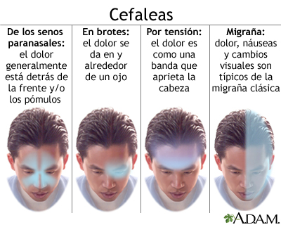 Clases de Medicina: CEFALEAS (DOLOR DE CABEZA)