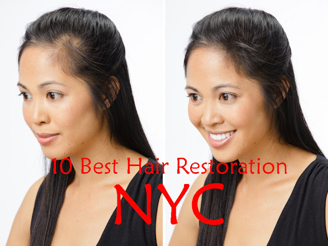 10 Best Hair Restoration Nyc Top 10 Hair Transplant In Nyc List Of