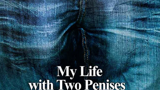 El cuñao: Increíble: hombre tiene dos penes y ambos funcionan, ¿cómo es ...