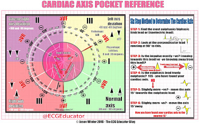 ECG Educator Blog : Cardiac Axis Made Easy