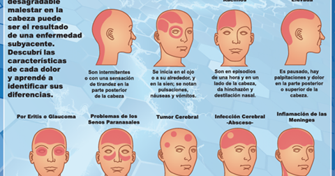 Semiología Médica: CEFALEA