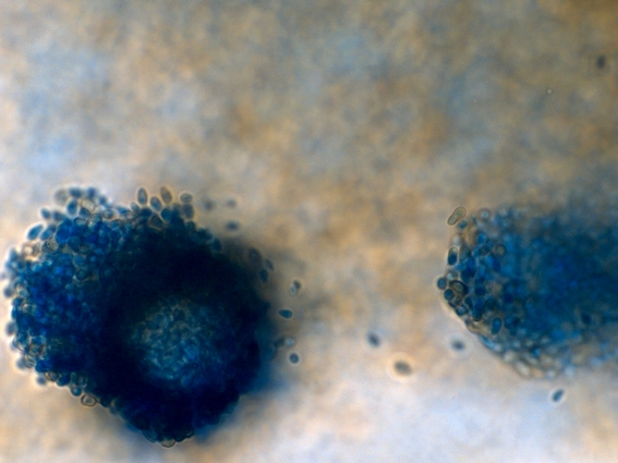 Fun With Microbiology (What's Buggin' You?): Phoma glomerata