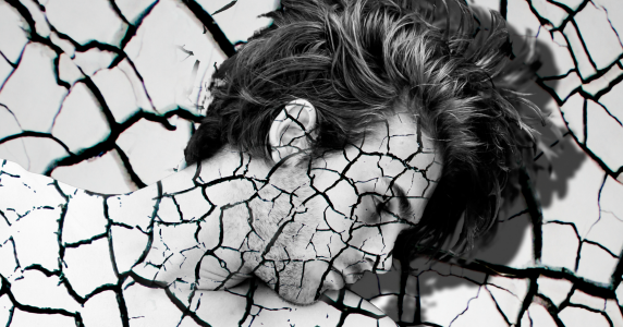 ageless beauty, timeless skin: Dehydrated Skin explained