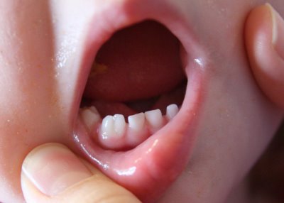 Mommy and Baby: How To Care For Your Kids Teeth (II)