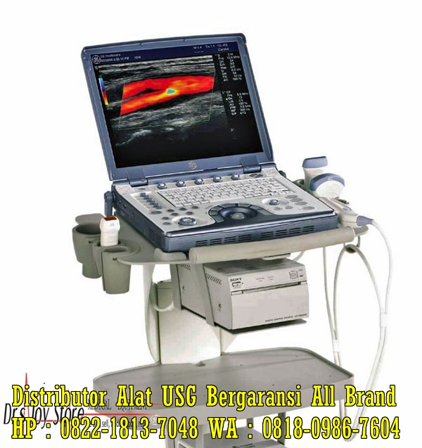 Science Archive: Alat USG doppler musculoskeletal