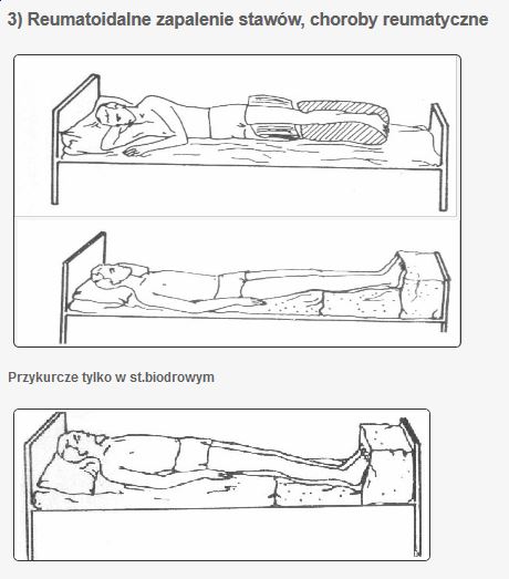 ASYSTUJEMY PIELĘGNIARKOM - blog dla osób uczących się na kierunku ...