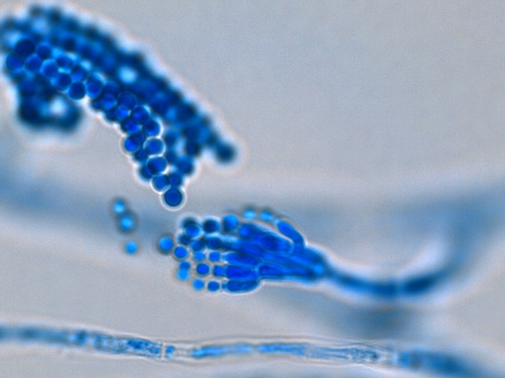 Fun With Microbiology (What's Buggin' You?): Penicillium species