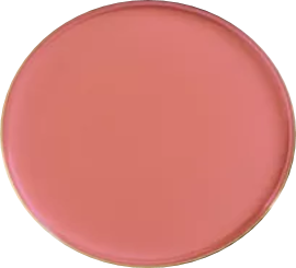 Blog del Laboratorio clinico : Agar SS