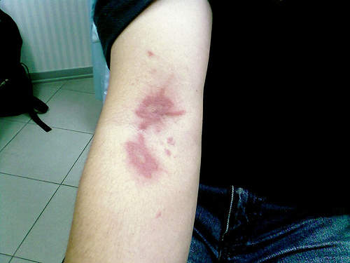 Tomcat dan Cara Mengatasi Serangga Tomcat