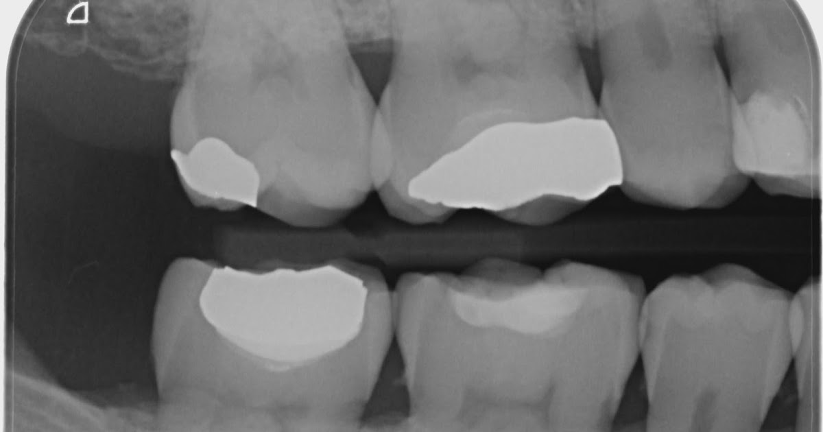 RAHMAN LABs. & DIGITAL X-RAY,OPG