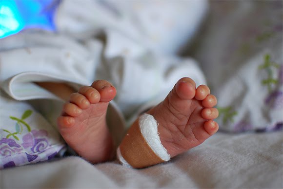 Shine Like Stars: Newborn Jaundice