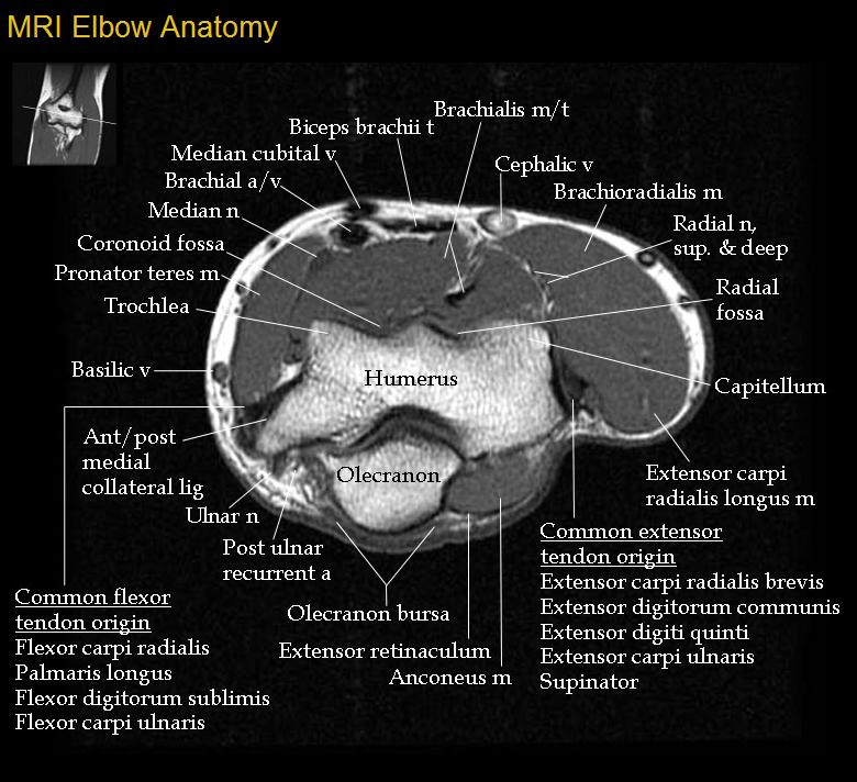Radioblog Rx: Atlas Musculoesquelético de RM