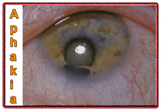 August 2016 - Sure Developers Team