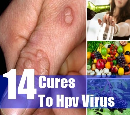 14 Cures To HPV Virus ~ Mzizi Mkavu
