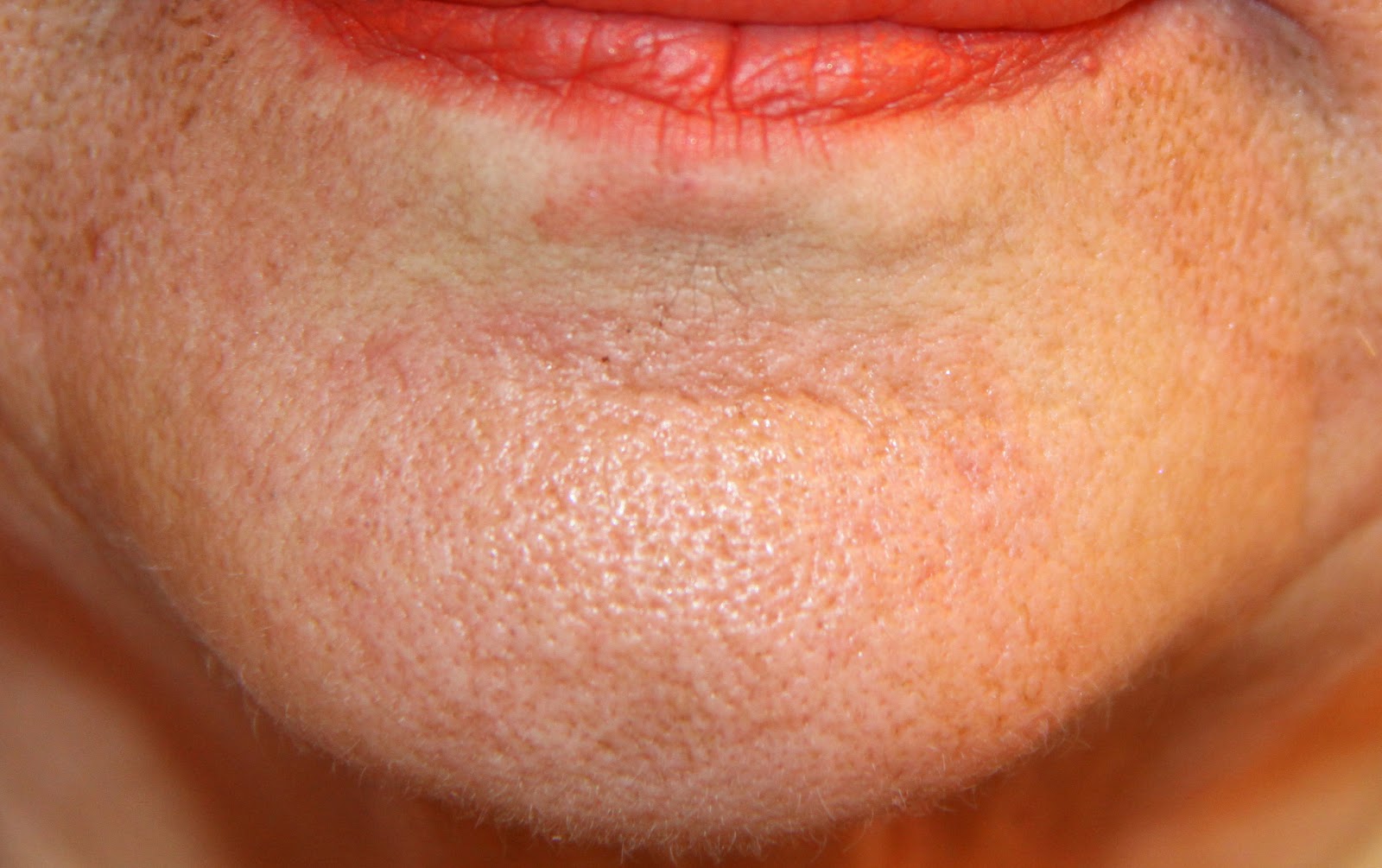 Dott. Stefano Vierucci Medicina e Chirurgia Estetica: LA CHIRURGIA NON ...