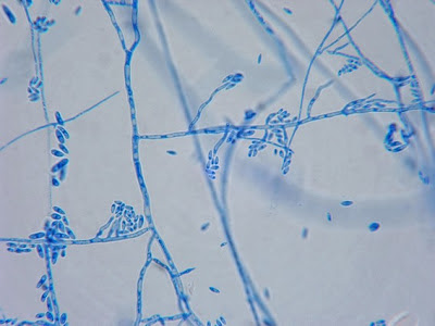 Fun With Microbiology (What's Buggin' You?): Fusarium oxysporum