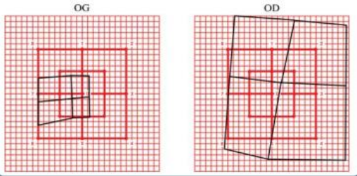 Test de Hess Lancaster