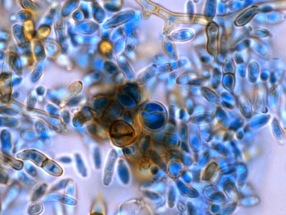 Fun With Microbiology (What's Buggin' You?): March 2014