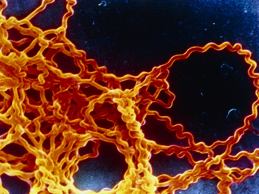 O que é Leptospirose ? - Análises Clínicas.com