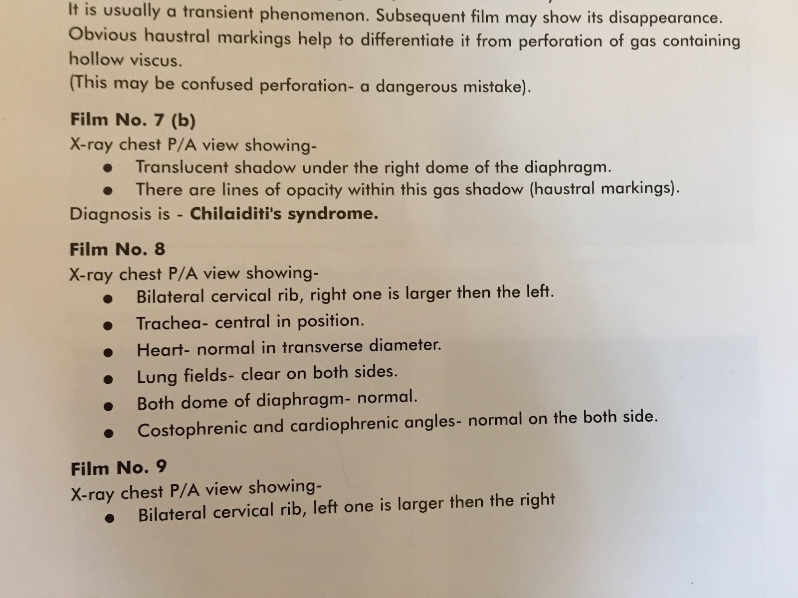 NORMAL VARIANT OF CHEST XRAY