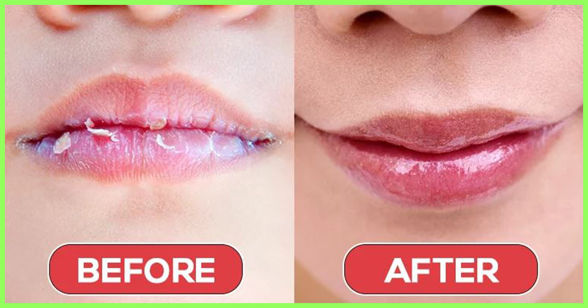 Get Rid of dry lips, dead skin or puffy eyes… - TOP 5 DIY