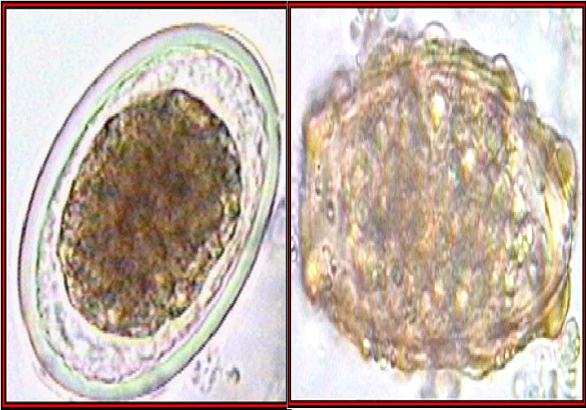 Perawat Profesional: Ascariasis (Cacingan)