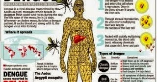 Dengue Fever and Platelet Count - Best Right Way