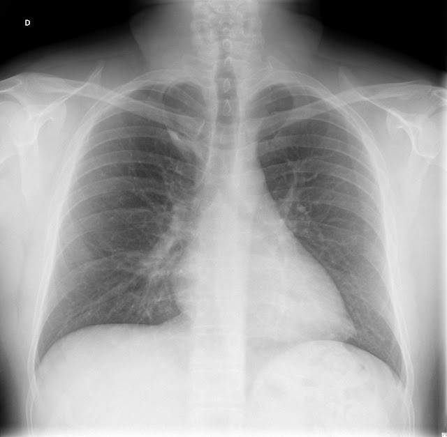 El Blog de Isa y Juan: El lóbulo de la ácigos