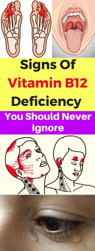 Signs Of Vitamin B12 Deficiency You Should Never Ignore - HEALTH CAPLET