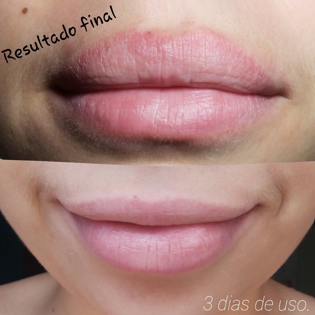 Diversos Femininos | Natália Viana: Dica :Boca queimada ou ressecada ...