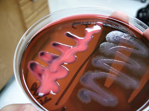 EOSIN METHYLENE BLUE (EMB) AGAR - Microbiology Lab Notes