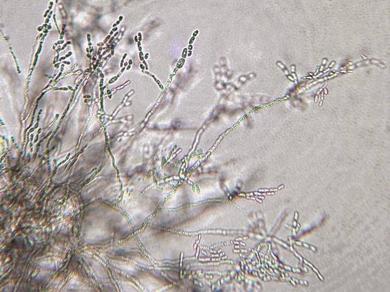 Fun With Microbiology (What's Buggin' You?): Trichosporon species