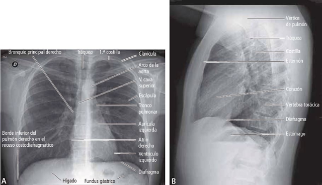 TORAX- RX FRENTE Y PERFIL