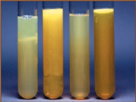[Microbiology] Atlas of Aerotolerance | Free Medical Atlas
