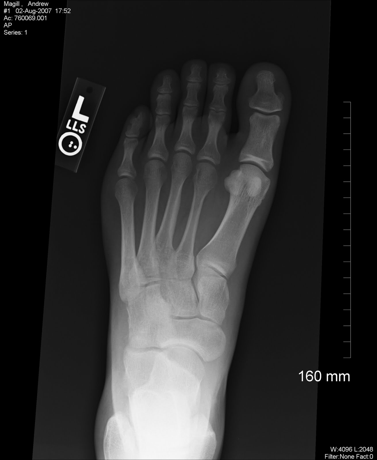 RTG zębów: Zdjęcia RTG