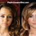 Miley cyrus plastic surgery before and after | World Celebrity